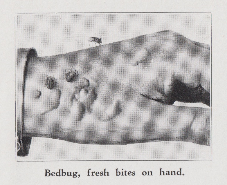 Bedbugs: The Social and Environmental History of an Urban Pest